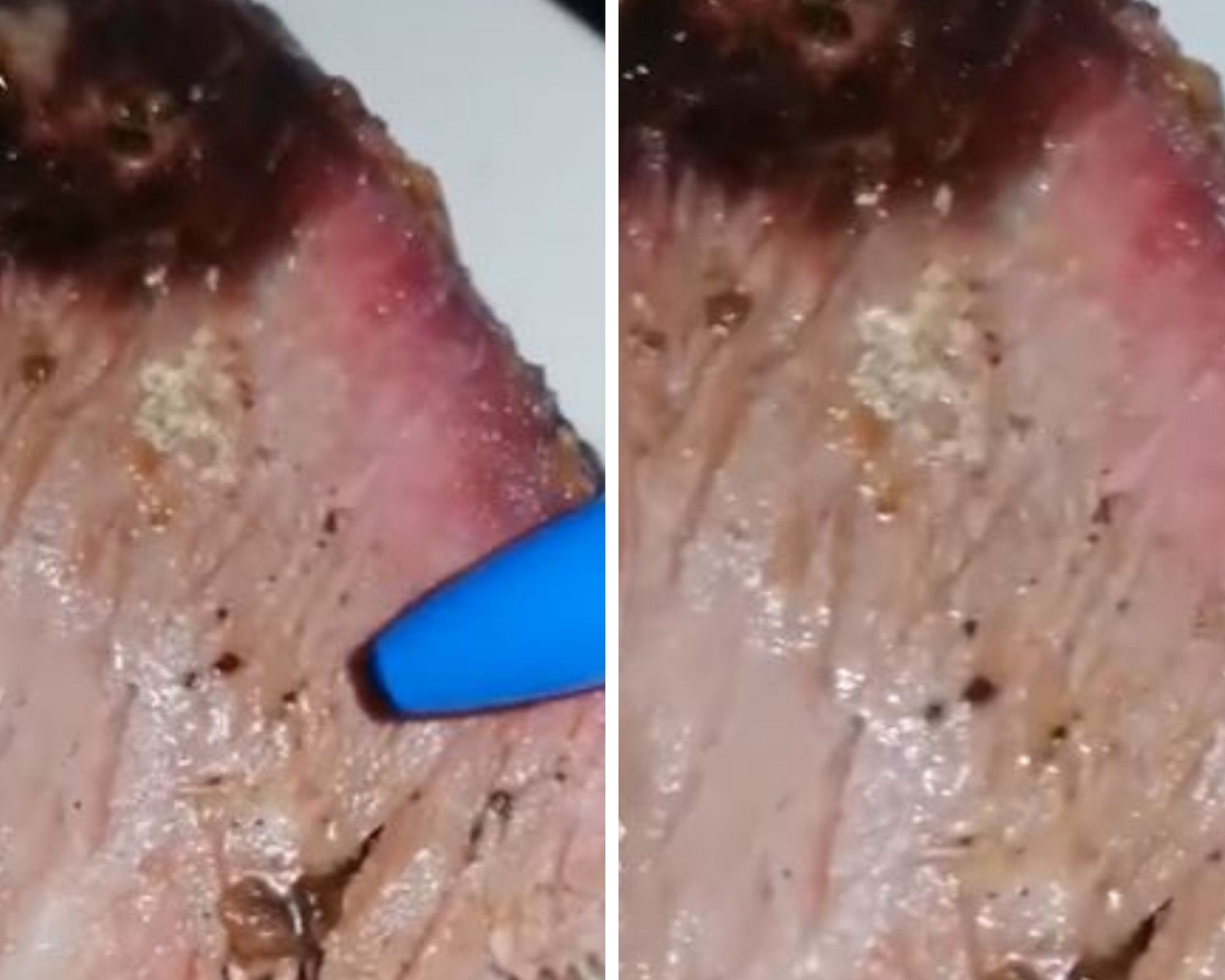 ¡Qué asco! Hombre encuentra 'larvas' en su carne, le dicen en el ...