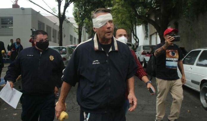 Afirma Alfredo Adame que ha perdido el 30% de la visión tras la golpiza ...